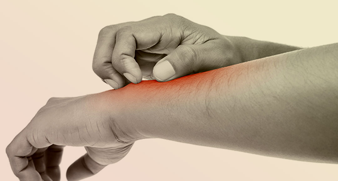 Evaluation of skin sensitizer when found as extractables - S&C BEST